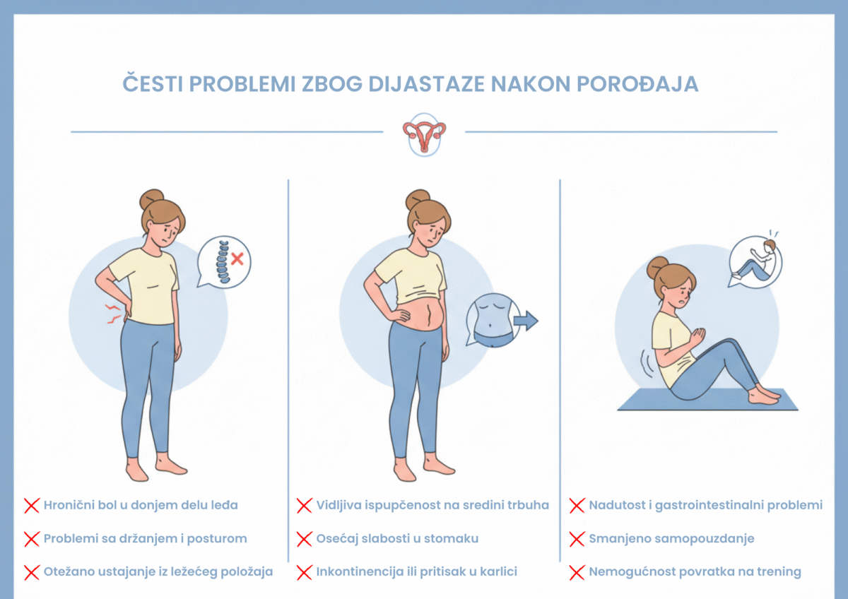 Dijastaza Trbušnih Mišića - Stručna Rehabilitacija | Fizio Fit